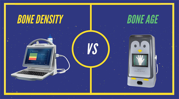 News - Is bone density the same as bone age? A simple understanding of ...
