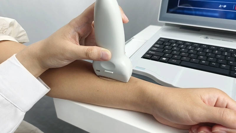 News - Scientific Maintenance Guide for Ultrasonic Bone Densitometer ...