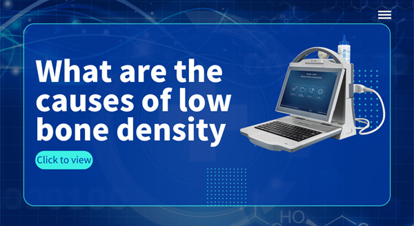 News - Is bone density the same as bone age? A simple understanding of ...