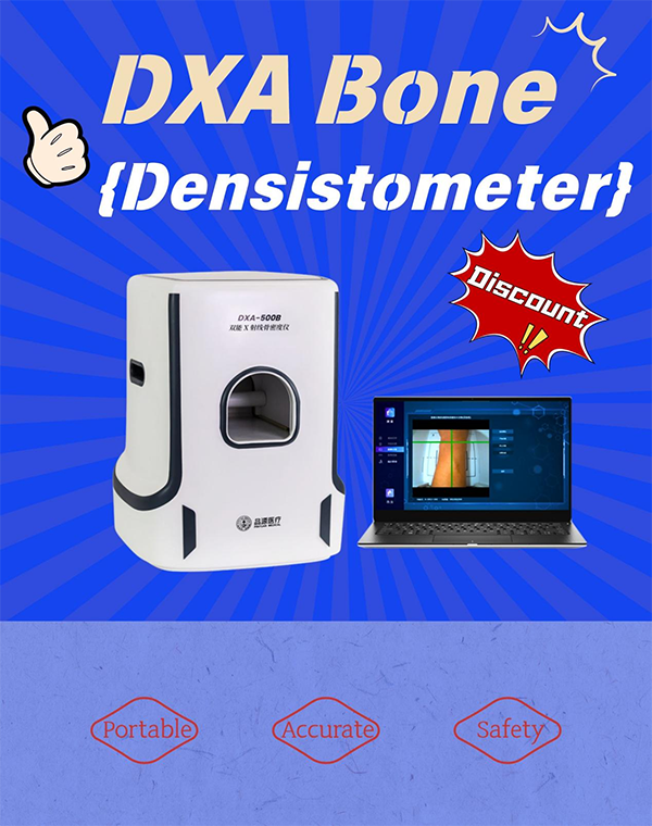 News - Portable dual-energy X-ray bone densitometer DXA-500B: Precise ...