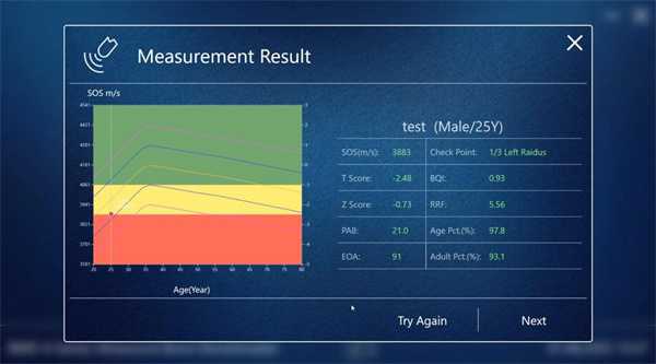 News - Which brand of bone density meter software is good to use?