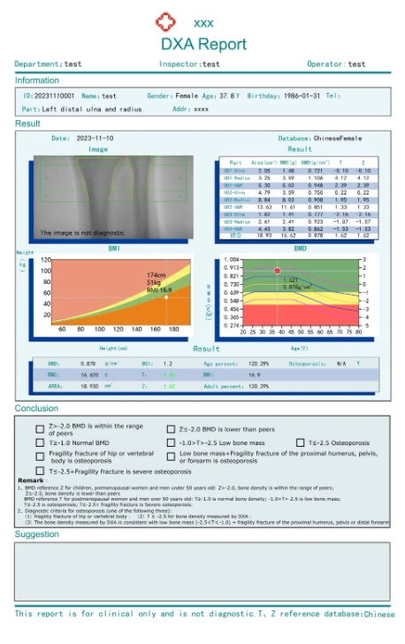 News - A complete guide to osteoporosis prevention and treatment ...