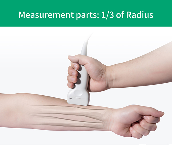 News - Bone mineral density examination There are five common ways to ...